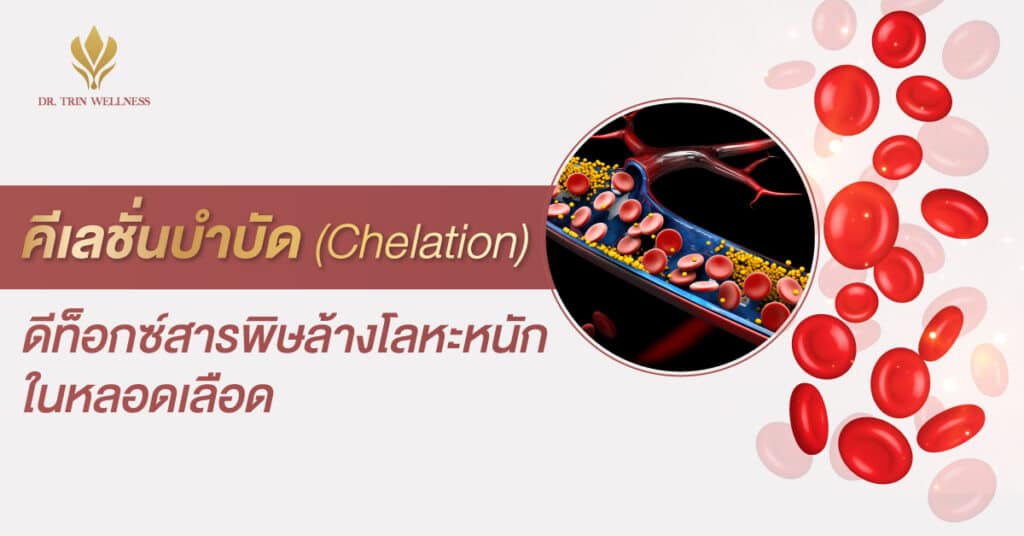 Chelation Therapy ดีท็อกซ์สารพิษกำจัดโลหะหนักในหลอดเลือด